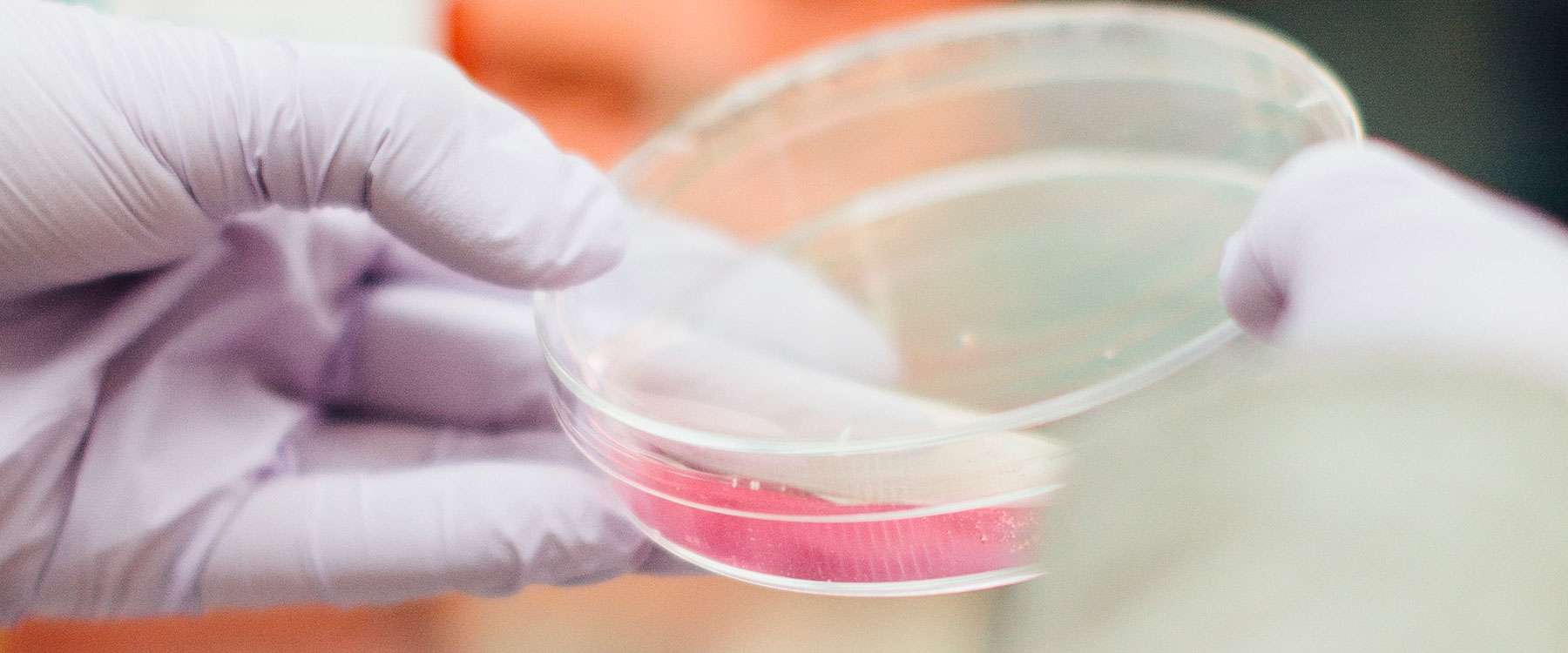 Abstriche, Antibiogramme und Antimykogramme - Birds Online