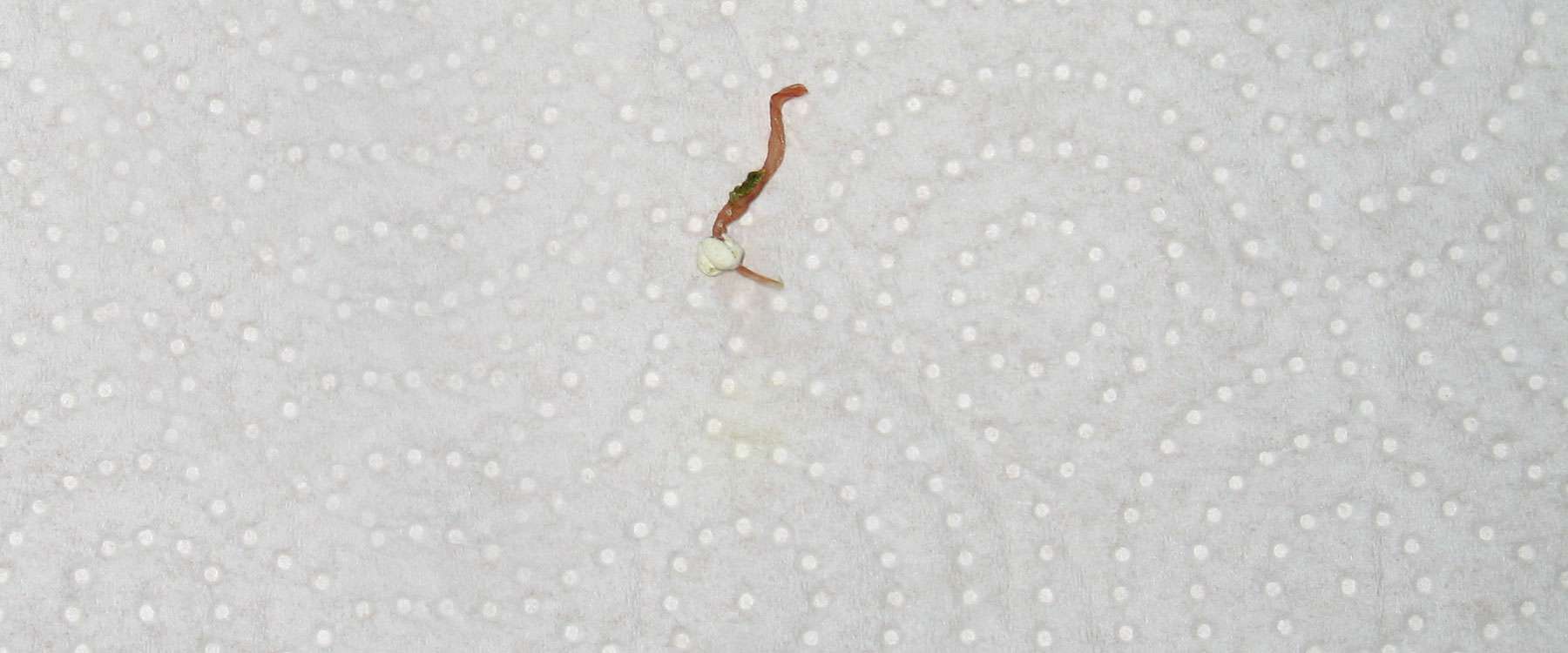 Roundworms - Birds Online